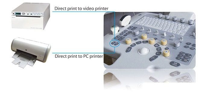 Ecograf doppler color Chison I3 - Medishop